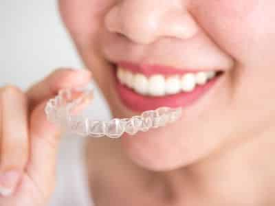 Pros and Cons of Invisalign Treatment - Dr. Lints Orthodontics